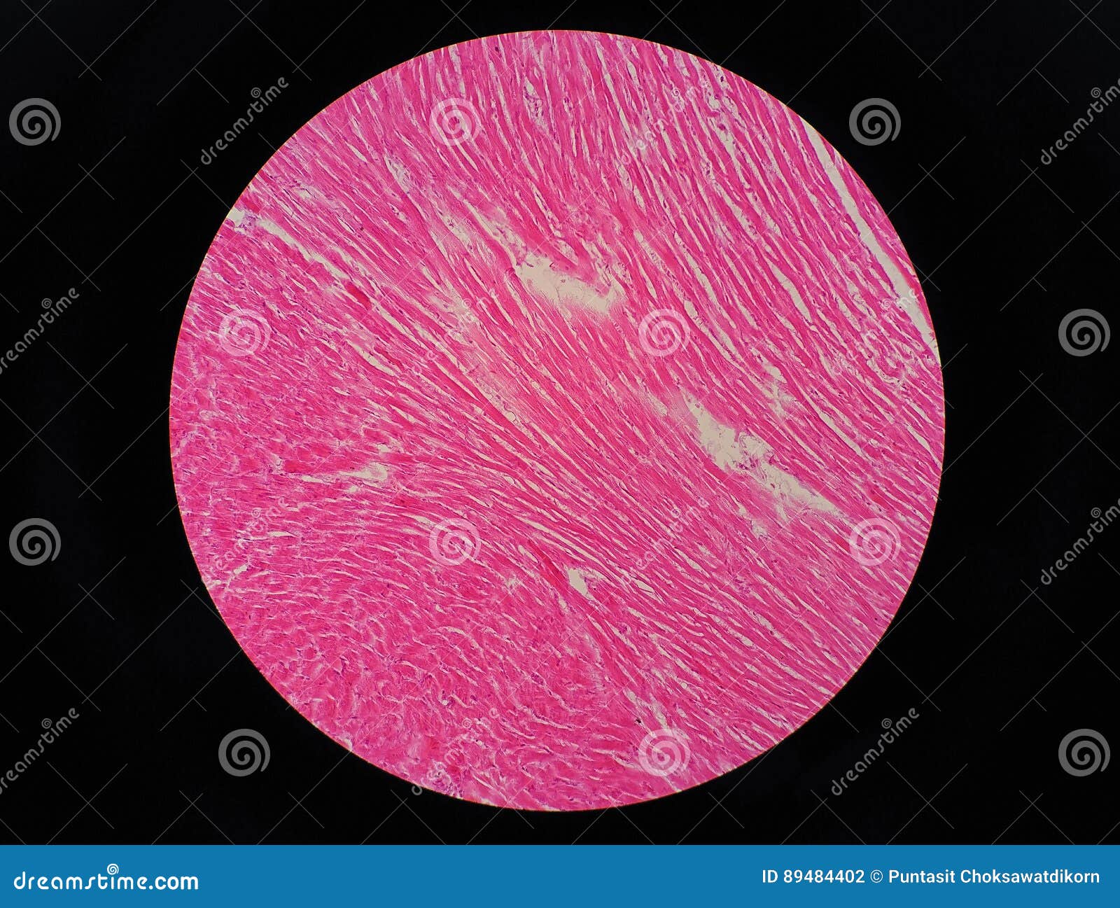 Histology Of Cardiac Muscle Under Microscope View Stock Photography ...