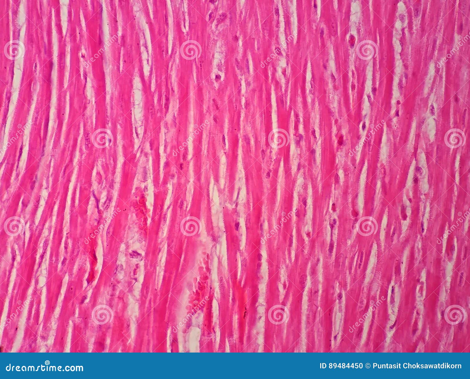Histology of Human Cardiac Muscle Stock Photo - Image of drawing ...