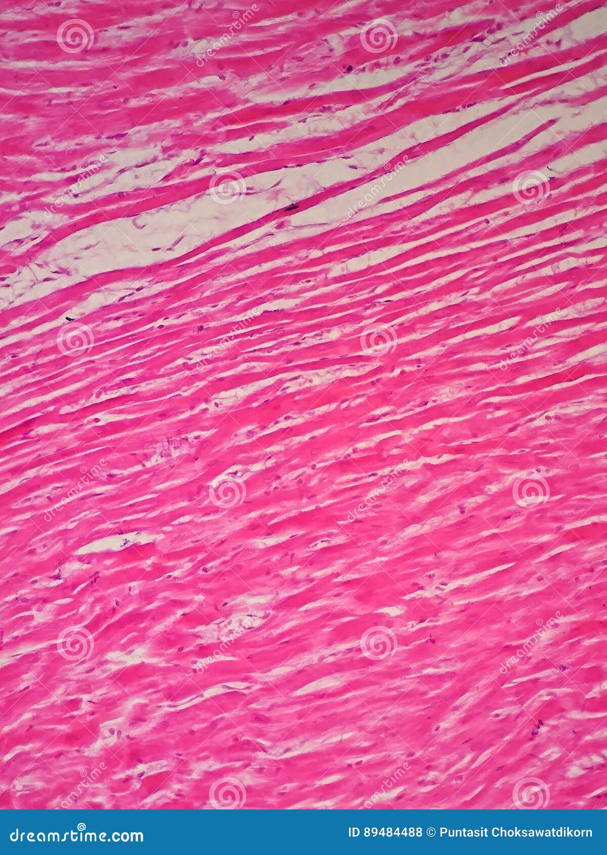 Histology of Human Cardiac Muscle Stock Photo - Image of coronary, body ...