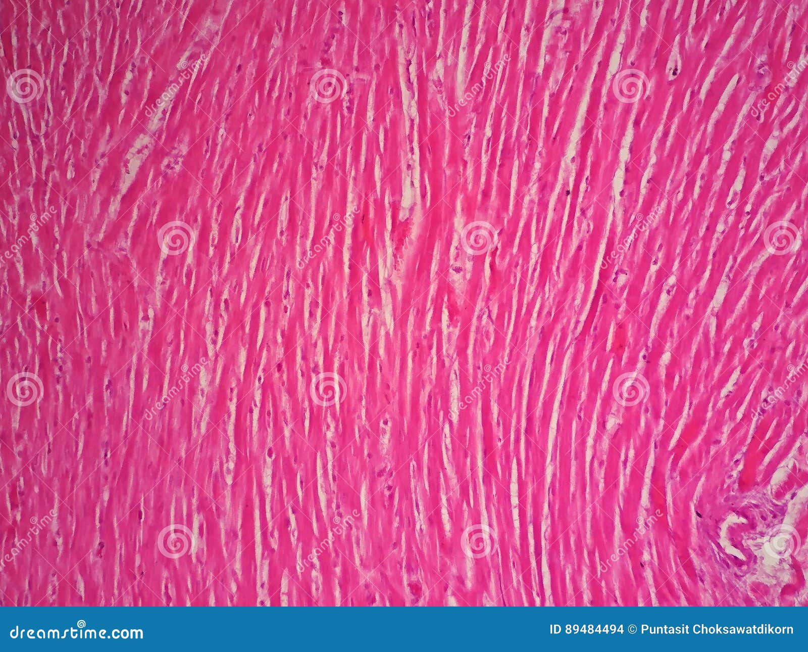 Histology of Human Cardiac Muscle Stock Photo - Image of disease, care ...