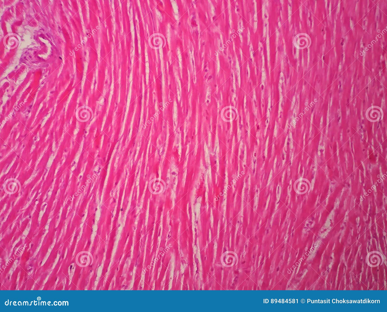 Histology of Human Cardiac Muscle Stock Image - Image of human, life ...