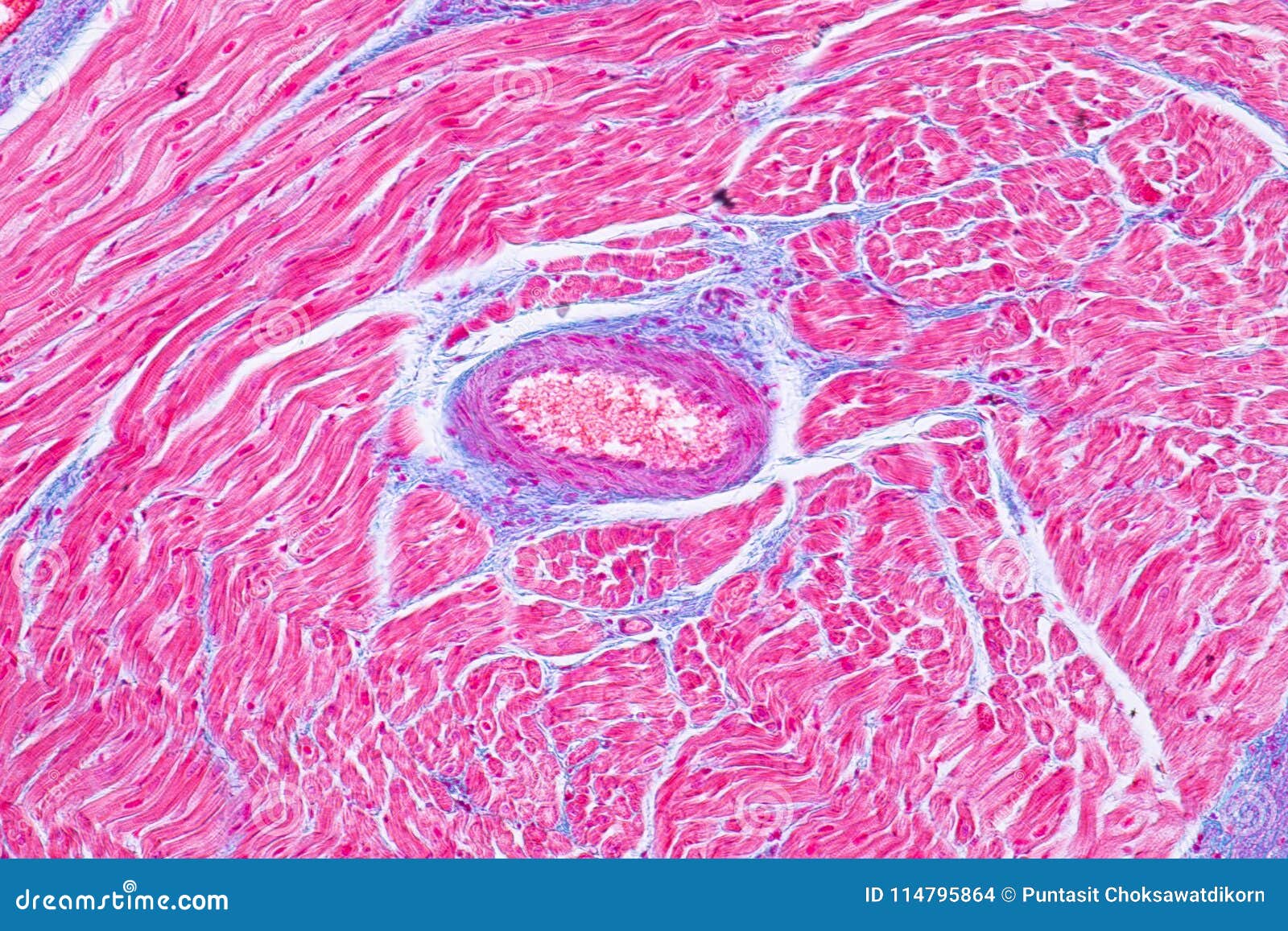 Muscle Cells Under A Microscope