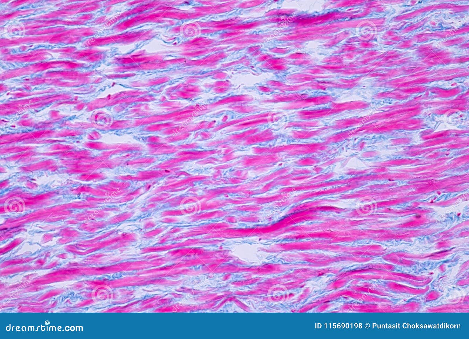 Histology of Human Cardiac Muscle Under Microscope View for Educ Stock ...