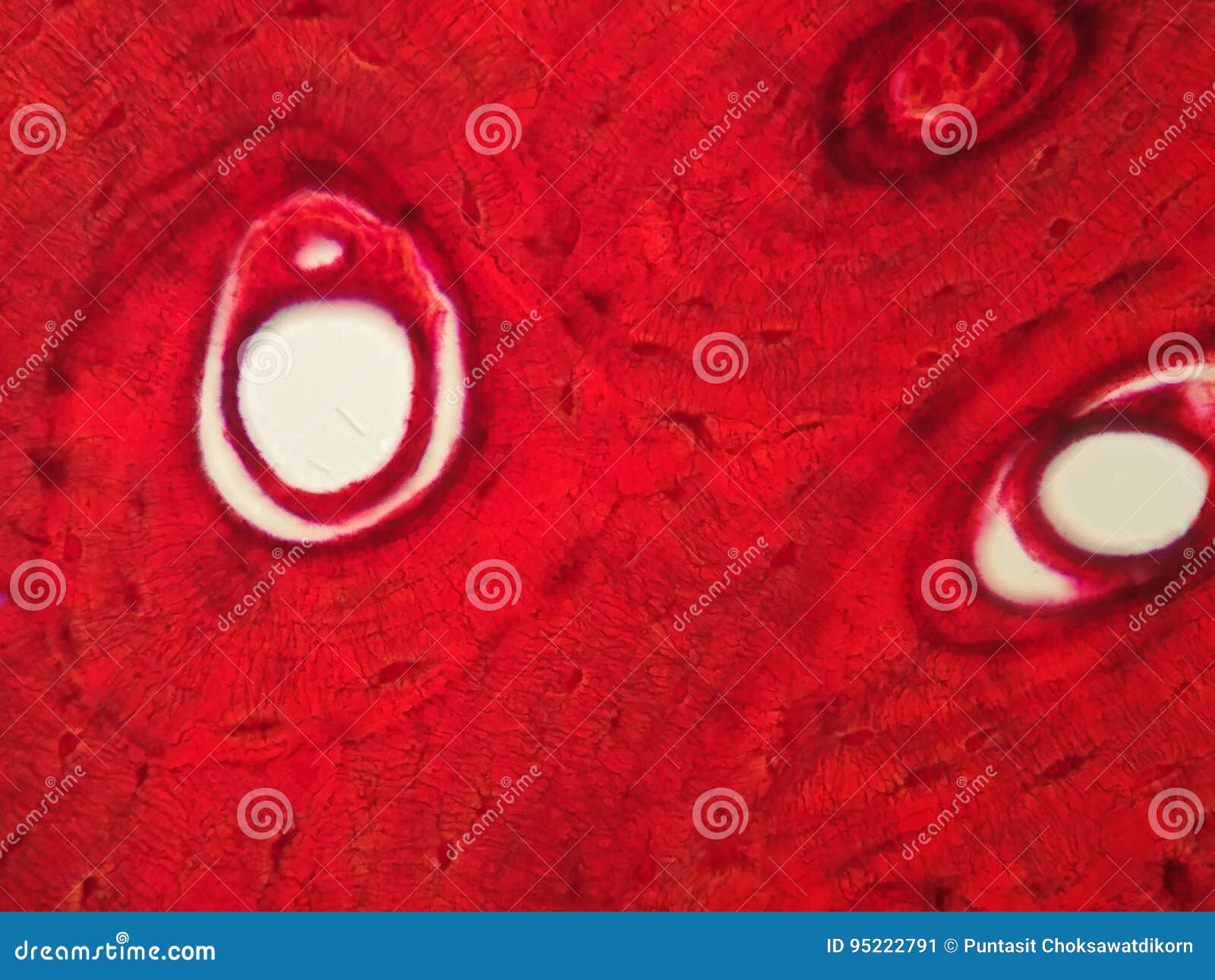 Histology of Human Compact Bone Tissue Stock Image - Image of ...