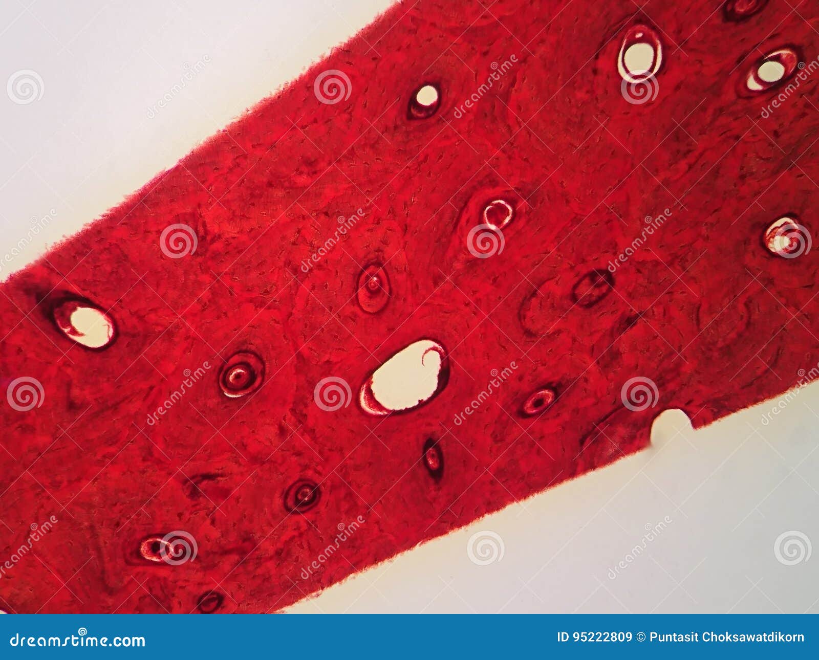 Histology of Human Compact Bone Tissue Stock Image - Image of medicine ...