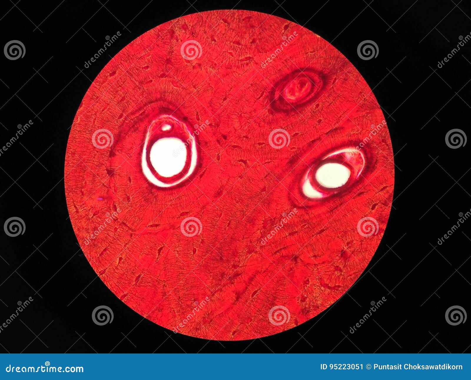 Histology of Human Compact Bone Tissue Stock Image - Image of ...