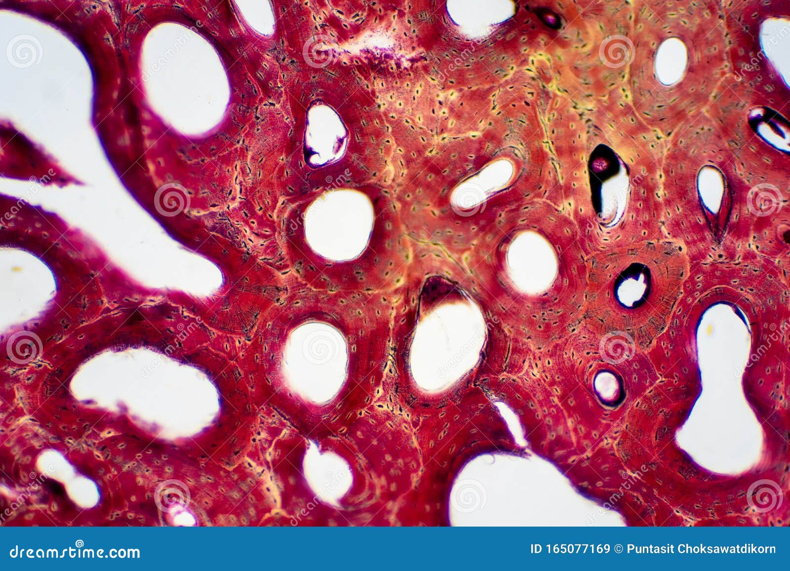 Histology of Human Compact Bone Tissue Under Microscope View for ...