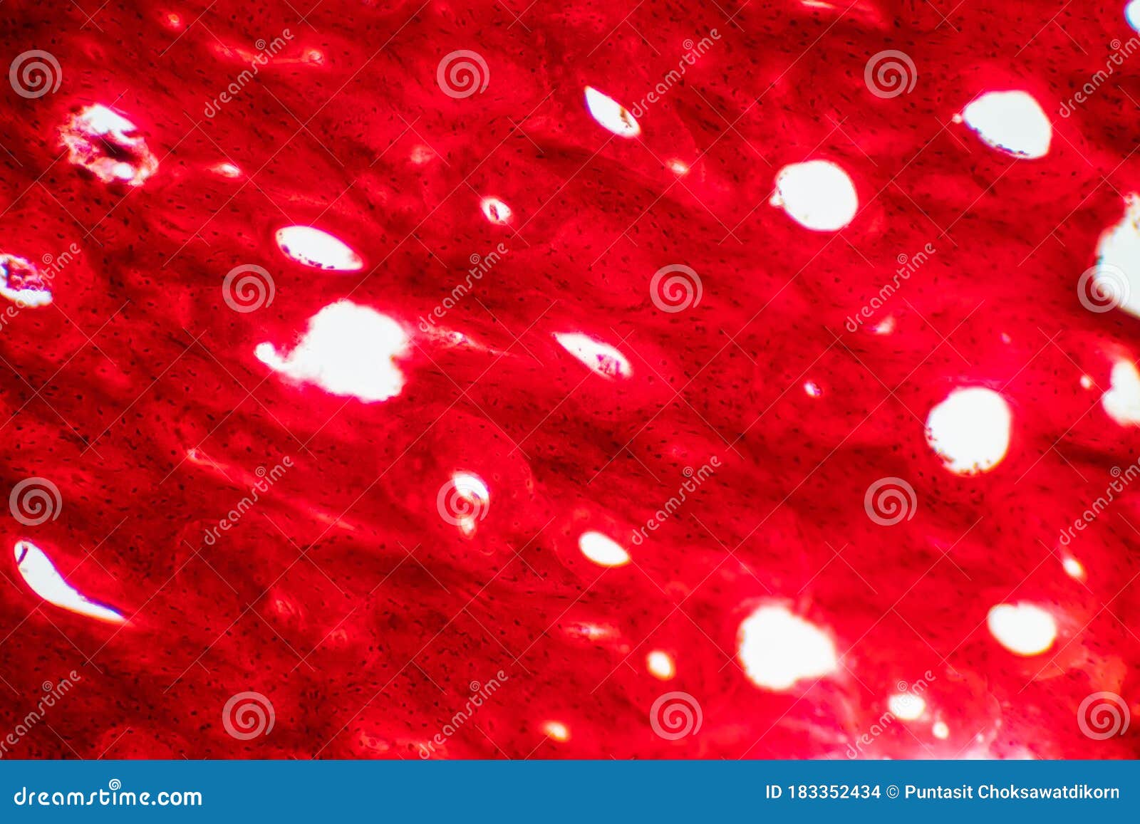 Histology of Human Compact Bone Tissue Under Microscope View for ...