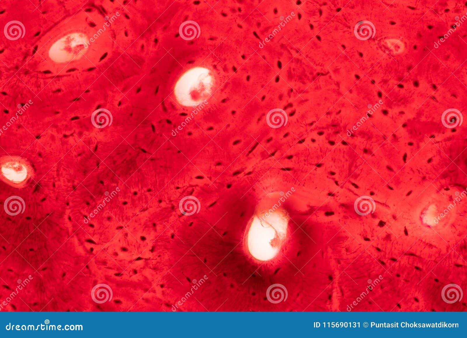 Histology of Human Compact Bone Tissue Under Microscope View for Stock ...