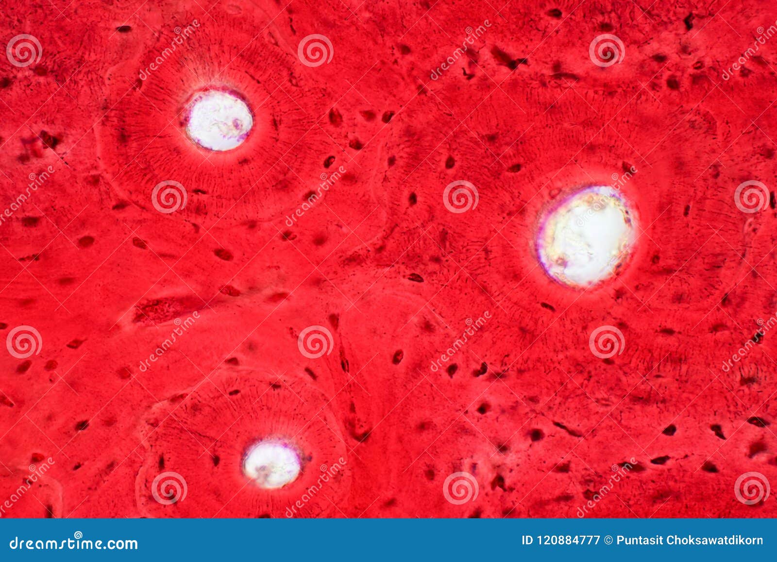 Histology of Human Compact Bone Tissue Under Microscope View for Stock ...