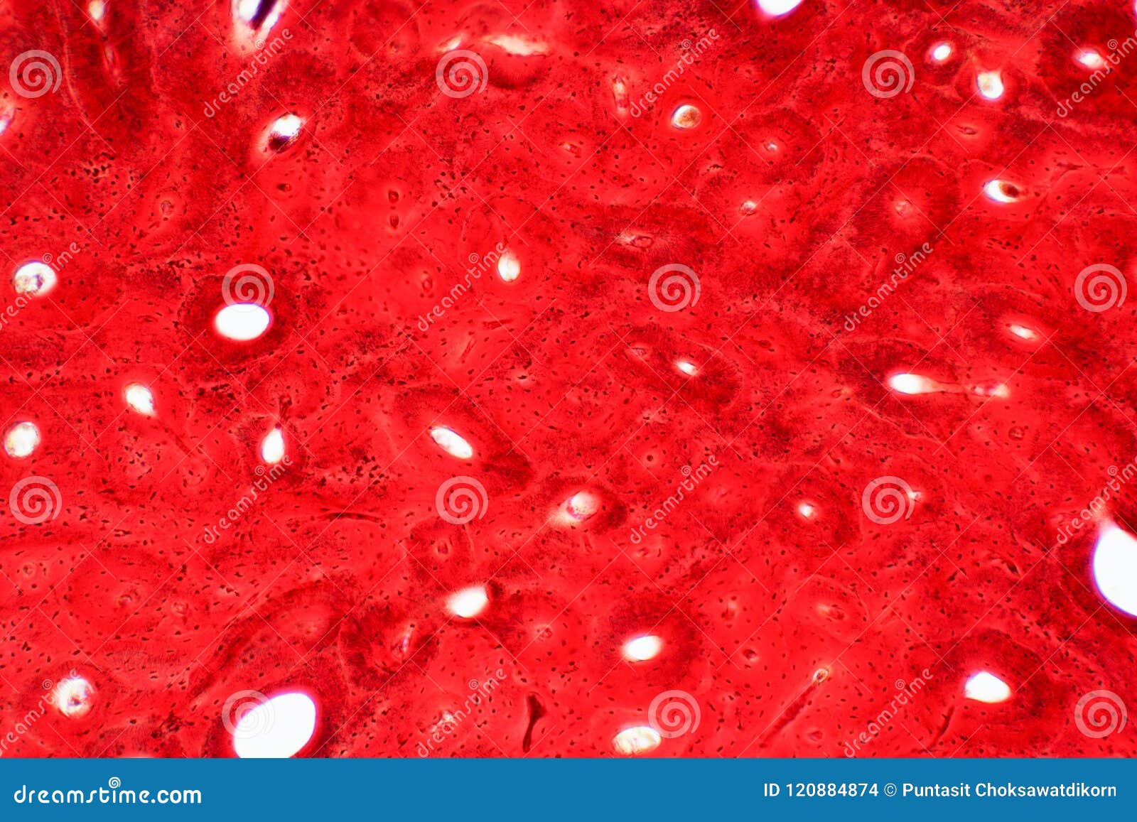Histology of Human Compact Bone Tissue Under Microscope View for Stock ...