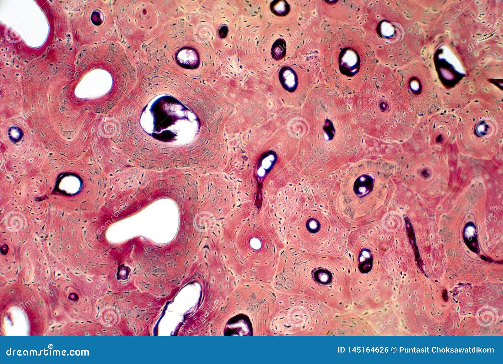 Histology of Human Compact Bone Tissue Under Microscope View for ...
