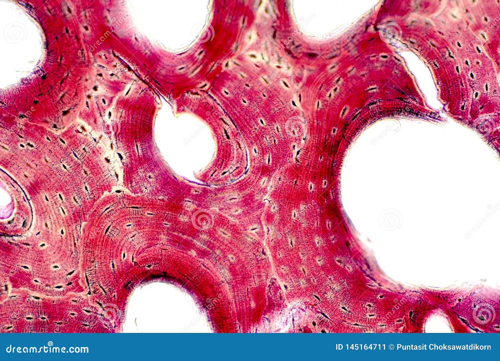 Histology of Human Compact Bone Tissue Under Microscope View for ...