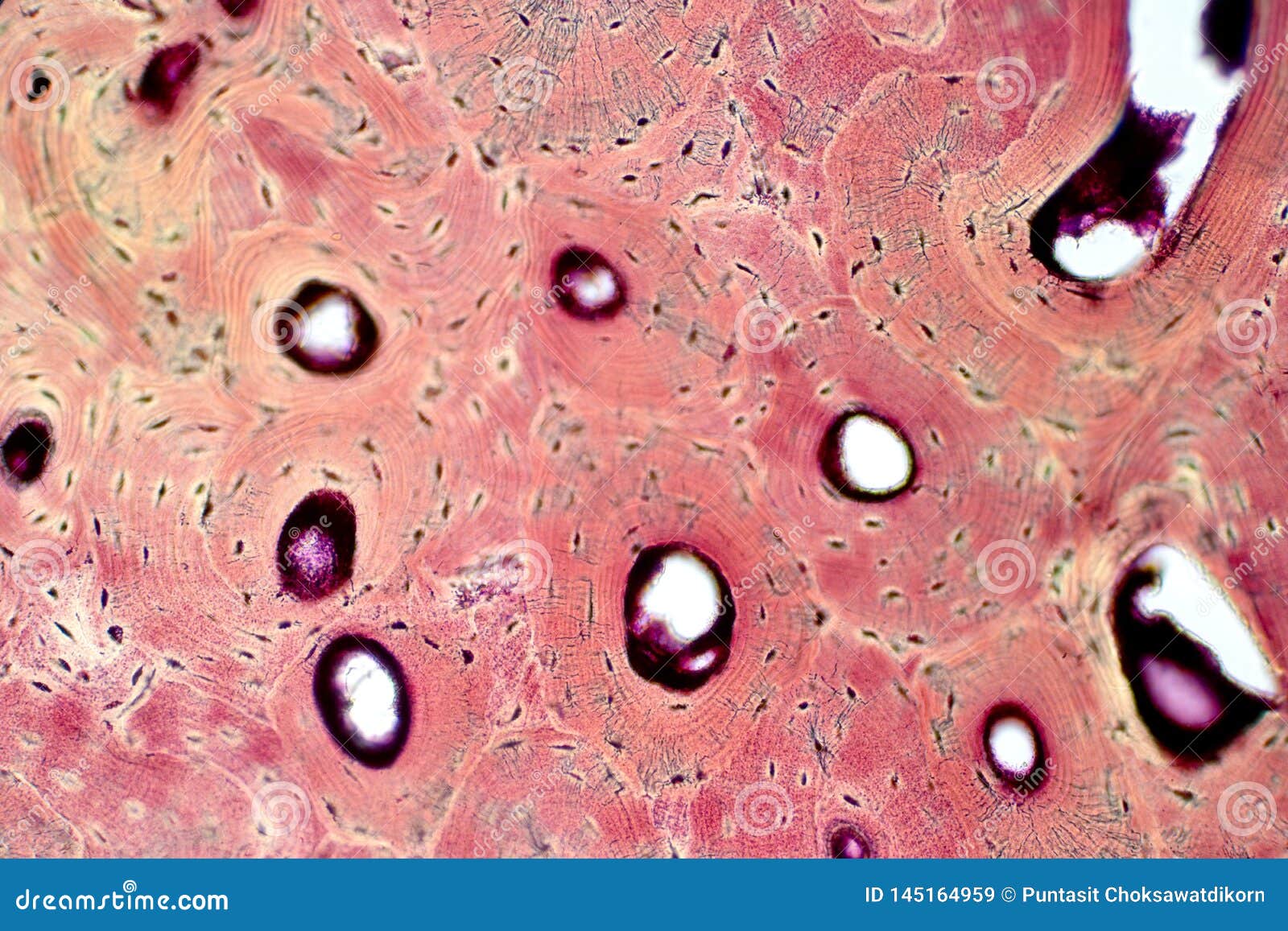 Histology of Human Compact Bone Tissue Under Microscope View for ...