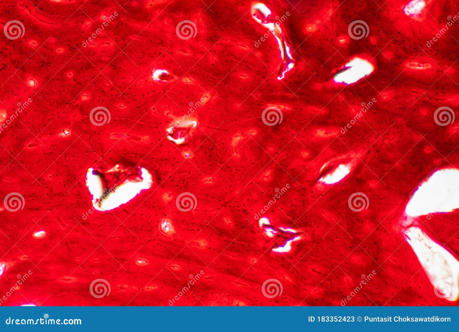 Histology of Human Compact Bone Tissue Under Microscope View for ...