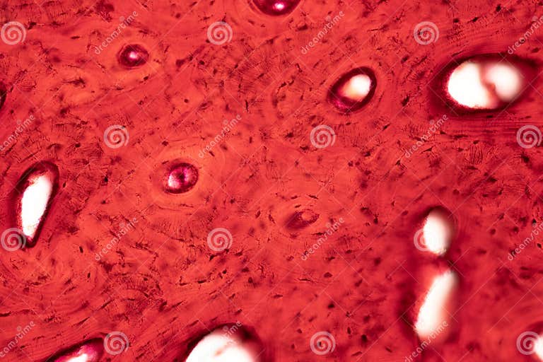 Histology of Human Compact Bone Tissue Under Microscope View for Stock ...