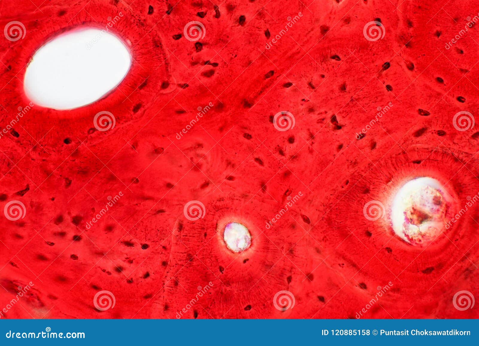 Histology of Human Compact Bone Tissue Under Microscope View for Stock ...