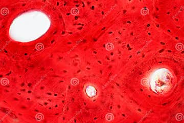 Histology of Human Compact Bone Tissue Under Microscope View for Stock ...