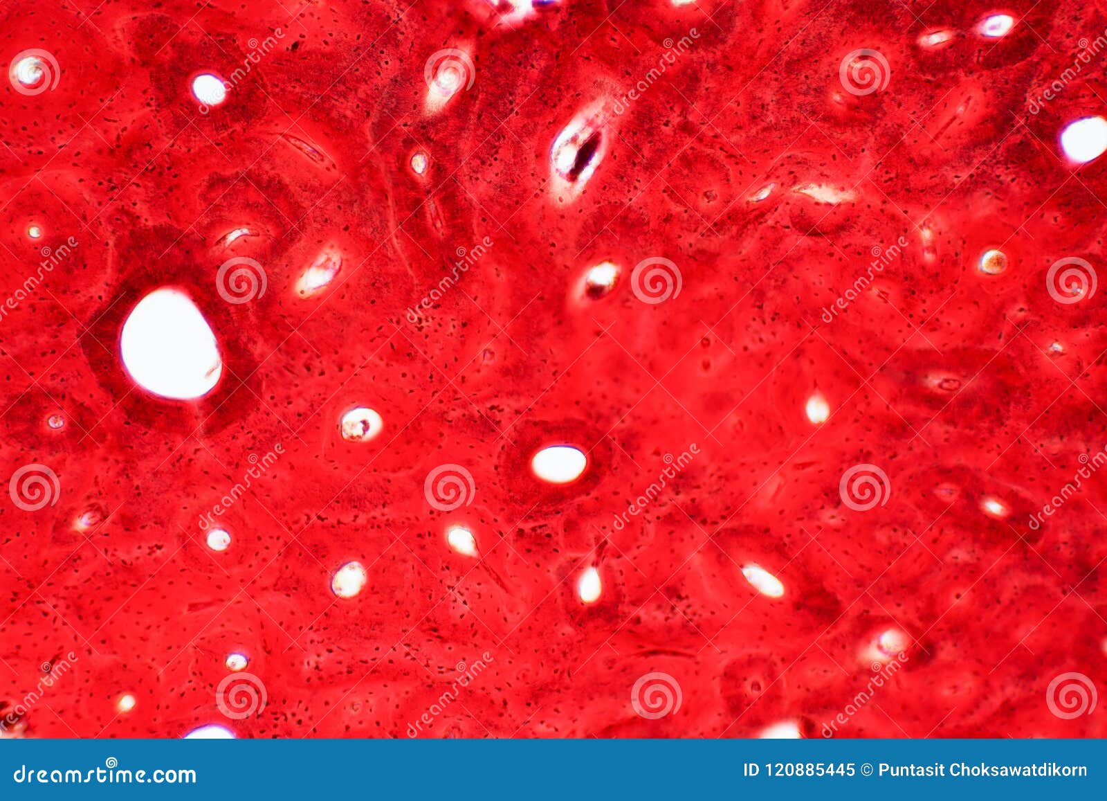 Histology of Human Compact Bone Tissue Under Microscope View for Stock ...