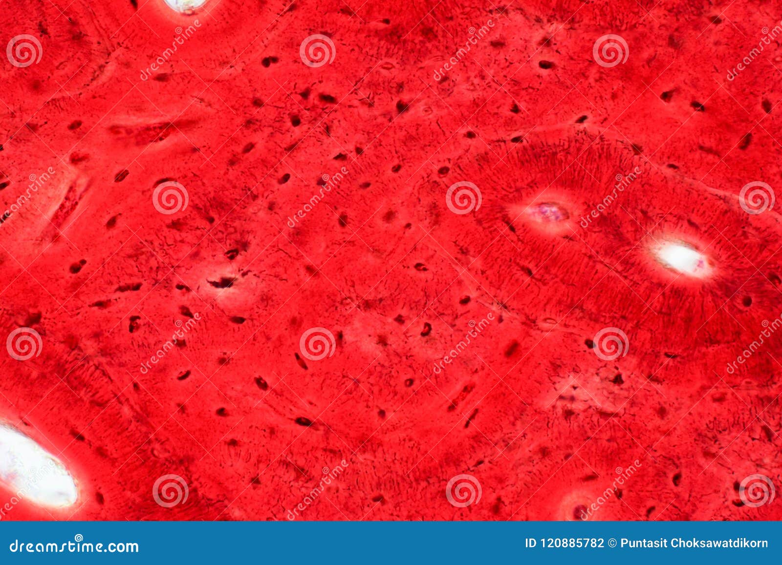 Histology of Human Compact Bone Tissue Under Microscope View for Stock ...