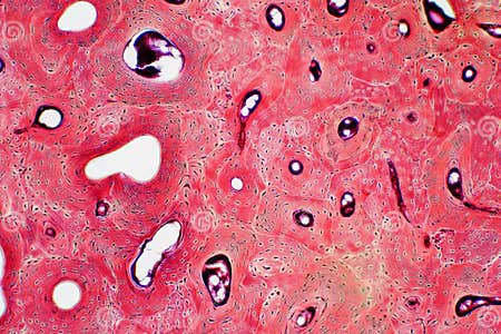 Histology of Human Compact Bone Tissue Under Microscope View for Stock ...