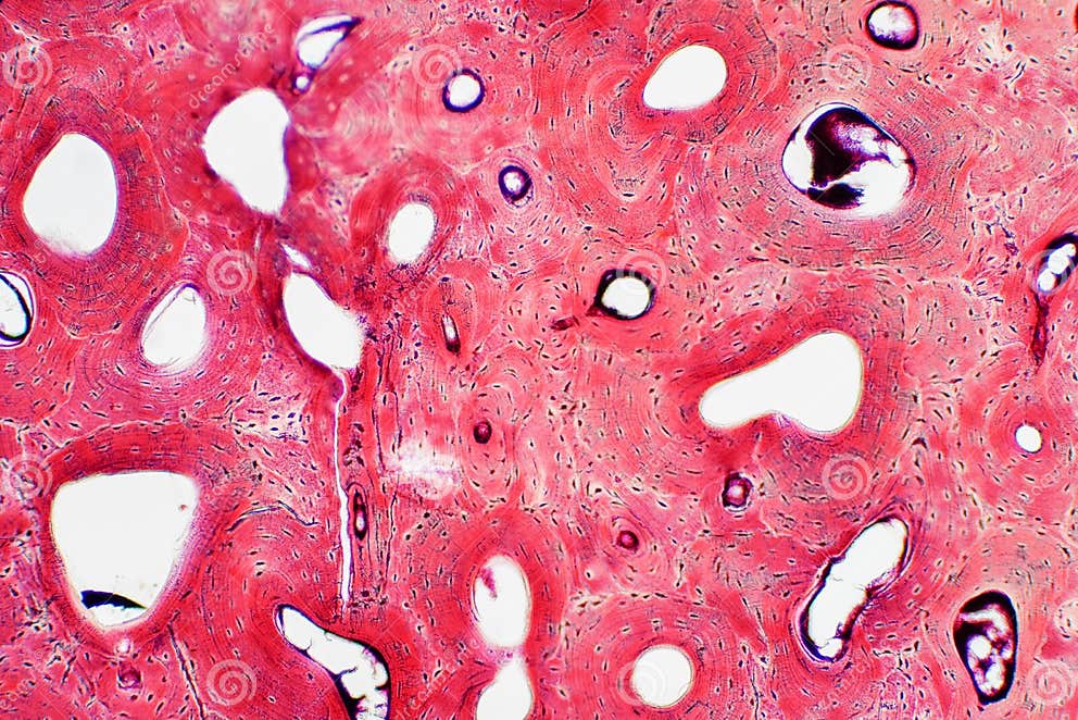 Histology of Human Compact Bone Tissue Under Microscope View for Stock ...