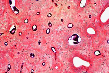 Histology of Human Compact Bone Tissue Under Microscope View for Stock ...