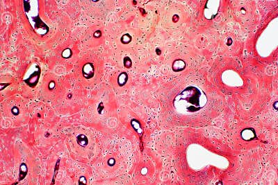 Histology of Human Compact Bone Tissue Under Microscope View for Stock ...