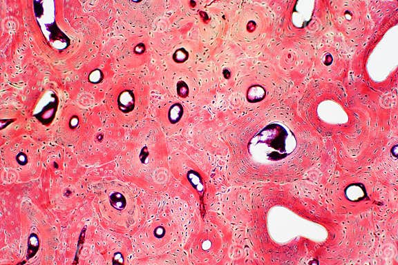 Histology of Human Compact Bone Tissue Under Microscope View for Stock ...