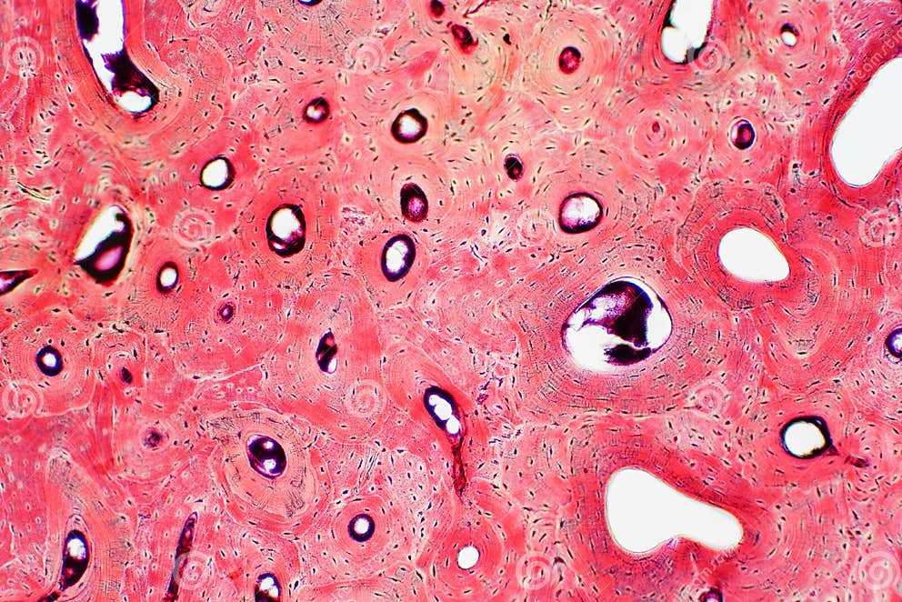 Histology of Human Compact Bone Tissue Under Microscope View for Stock ...