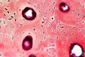 Histology of Human Compact Bone Tissue Under Microscope View for Stock ...