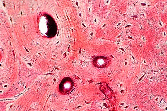 Histology of Human Compact Bone Tissue Under Microscope View for Stock ...