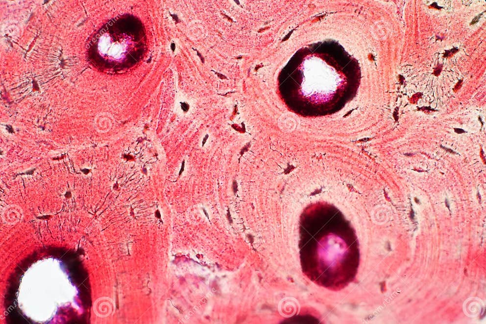 Histology of Human Compact Bone Tissue Under Microscope View for Stock ...