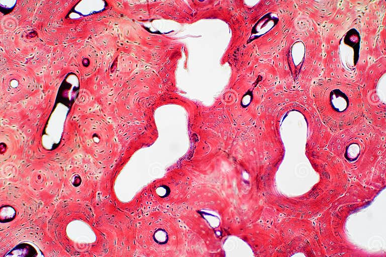 Histology of Human Compact Bone Tissue Under Microscope View for Stock ...