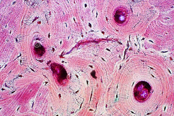 Histology of Human Compact Bone Tissue Under Microscope View for Stock ...