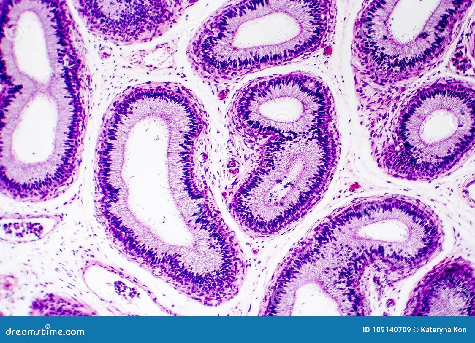 Labeled Epididymis Microscope Slide