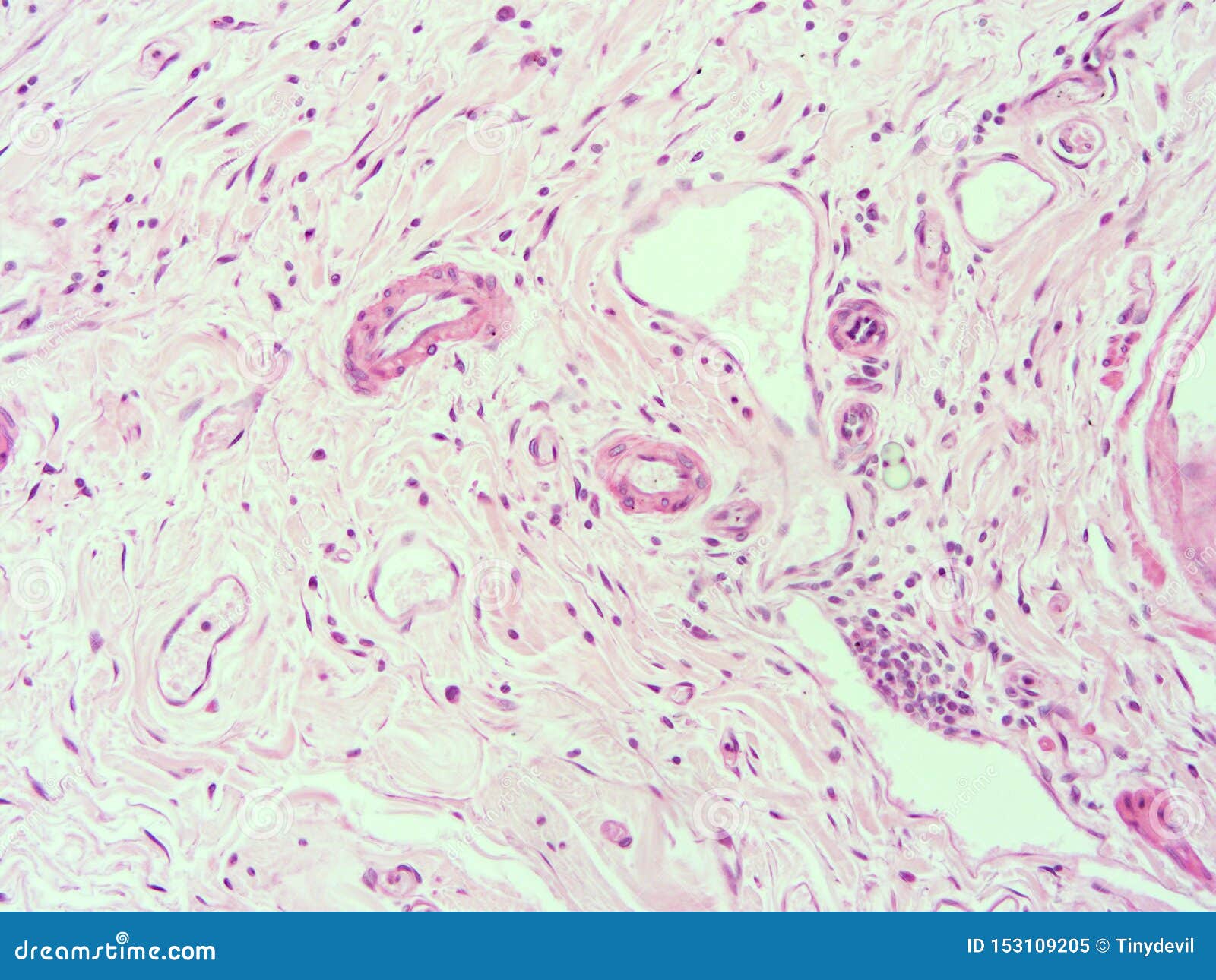 Histology of Human Gallbladder Tissue Stock Image - Image of ...