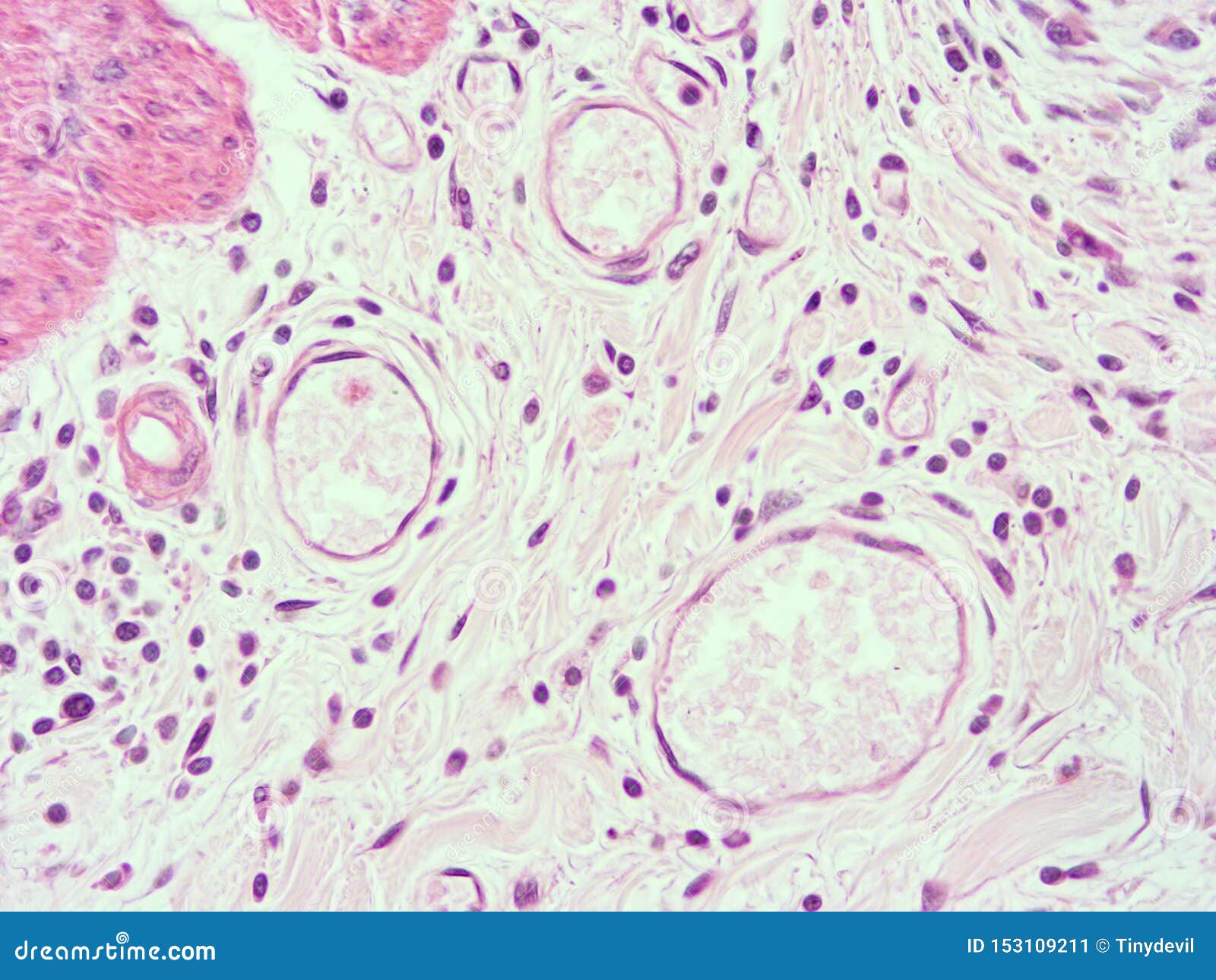 Histology of Human Gallbladder Tissue Stock Image - Image of columnar ...