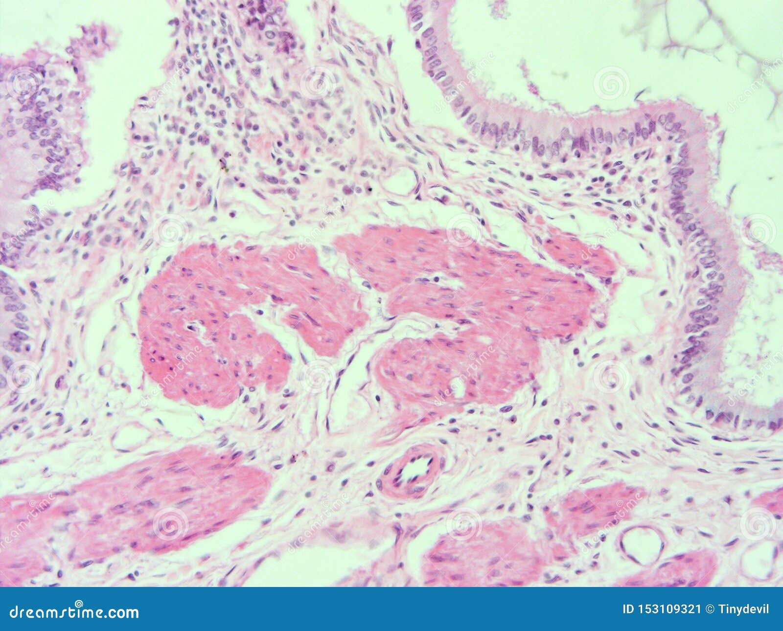 Histology of Human Gallbladder Tissue Stock Image - Image of physiology ...