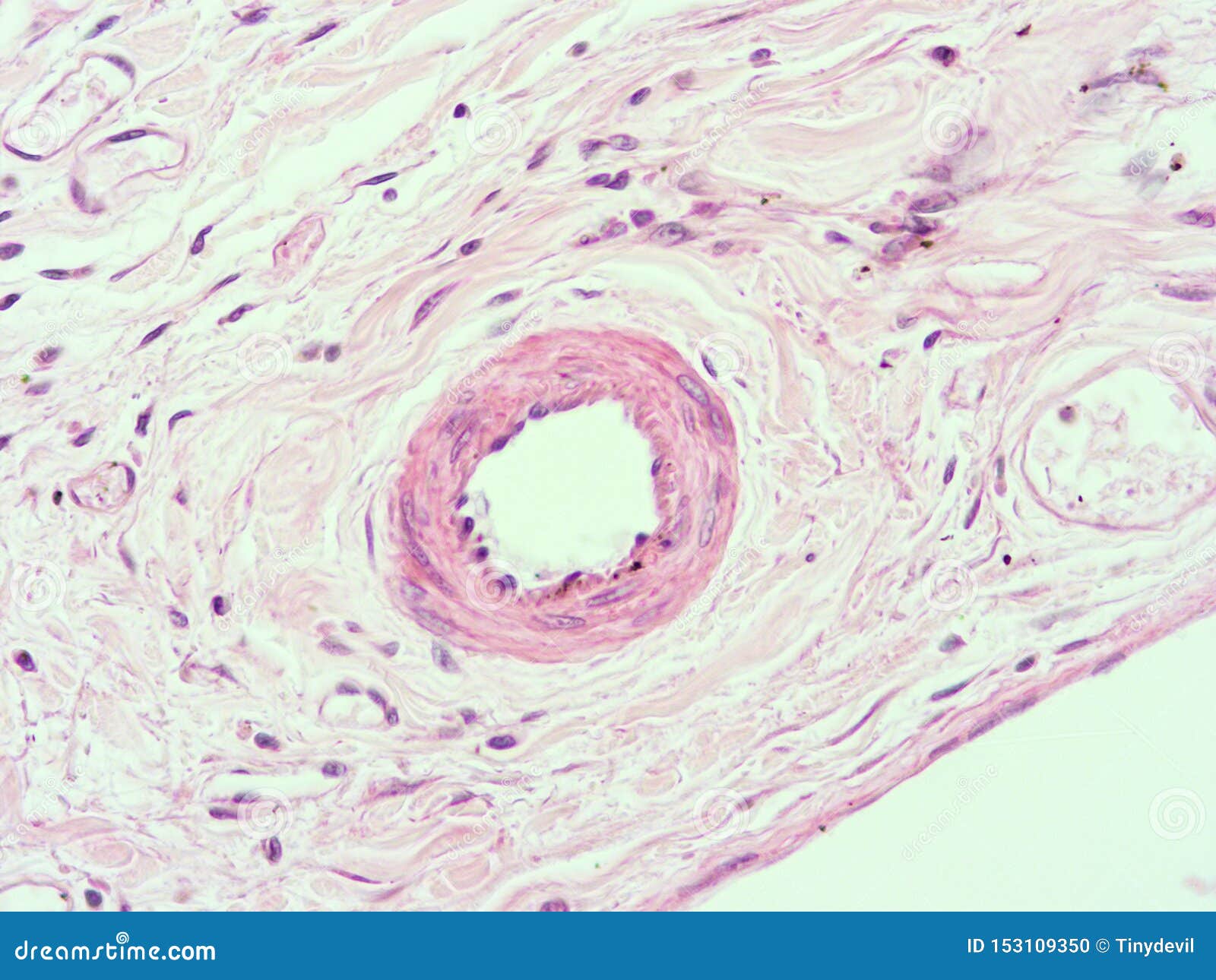 Histology of Human Gallbladder Tissue Stock Photo - Image of ...
