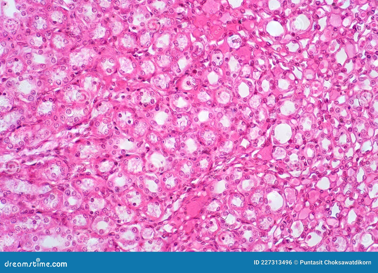 Histology of Human Kidney Tissue Under Light Microscope View for ...