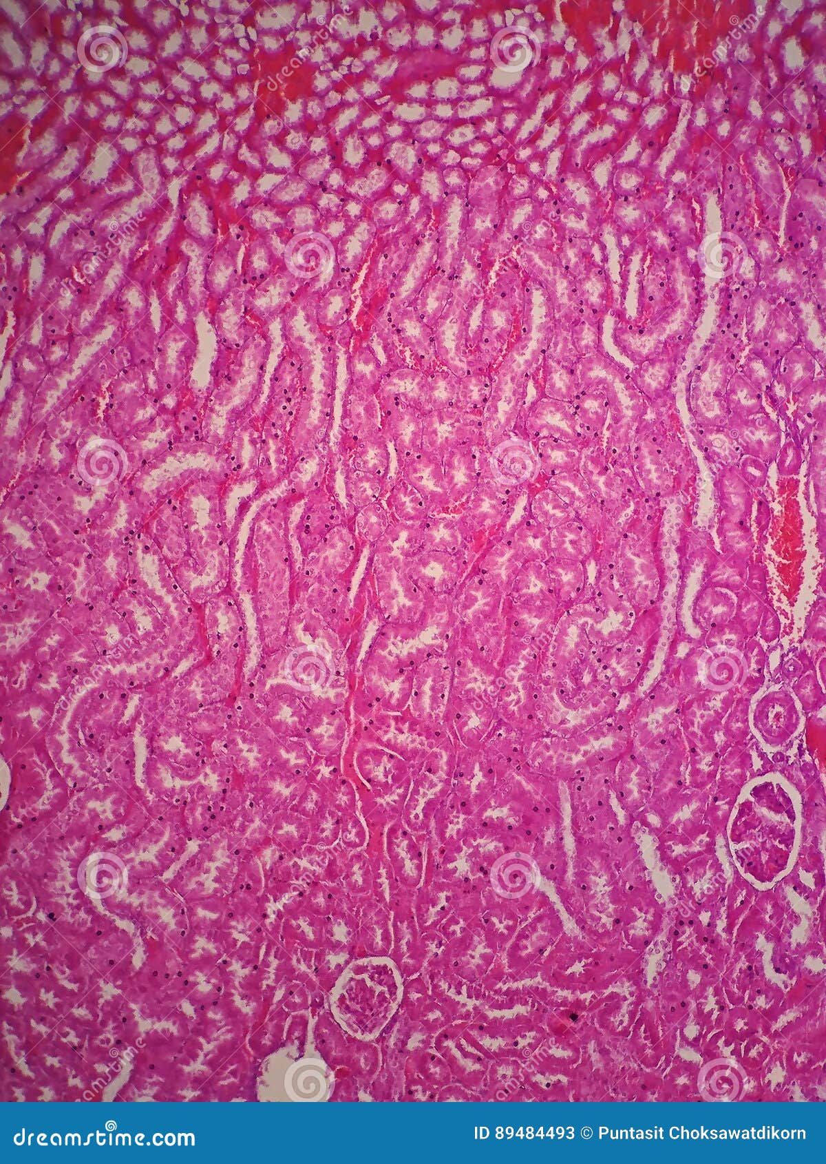 Histology of human kidney stock image. Image of care - 89484493