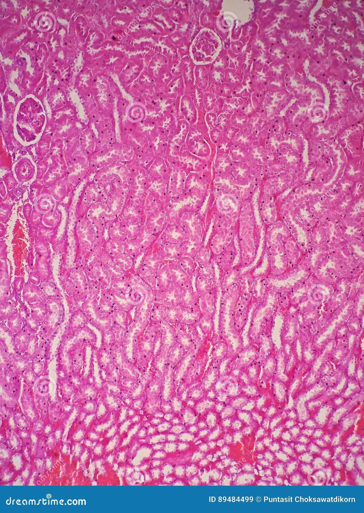 Histology of human kidney stock image. Image of anatomy - 89484499