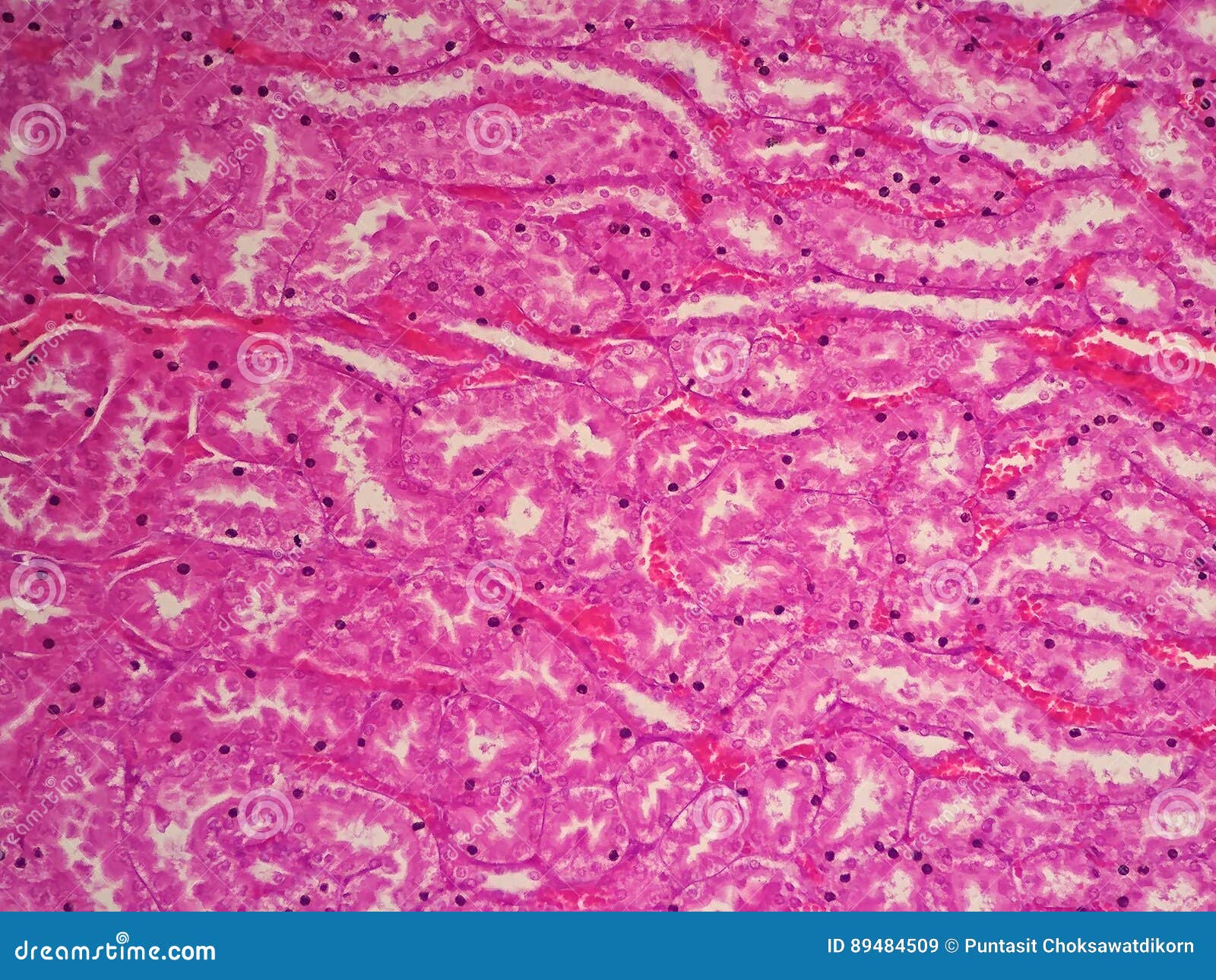 Histology of human kidney stock image. Image of medulla - 89484509