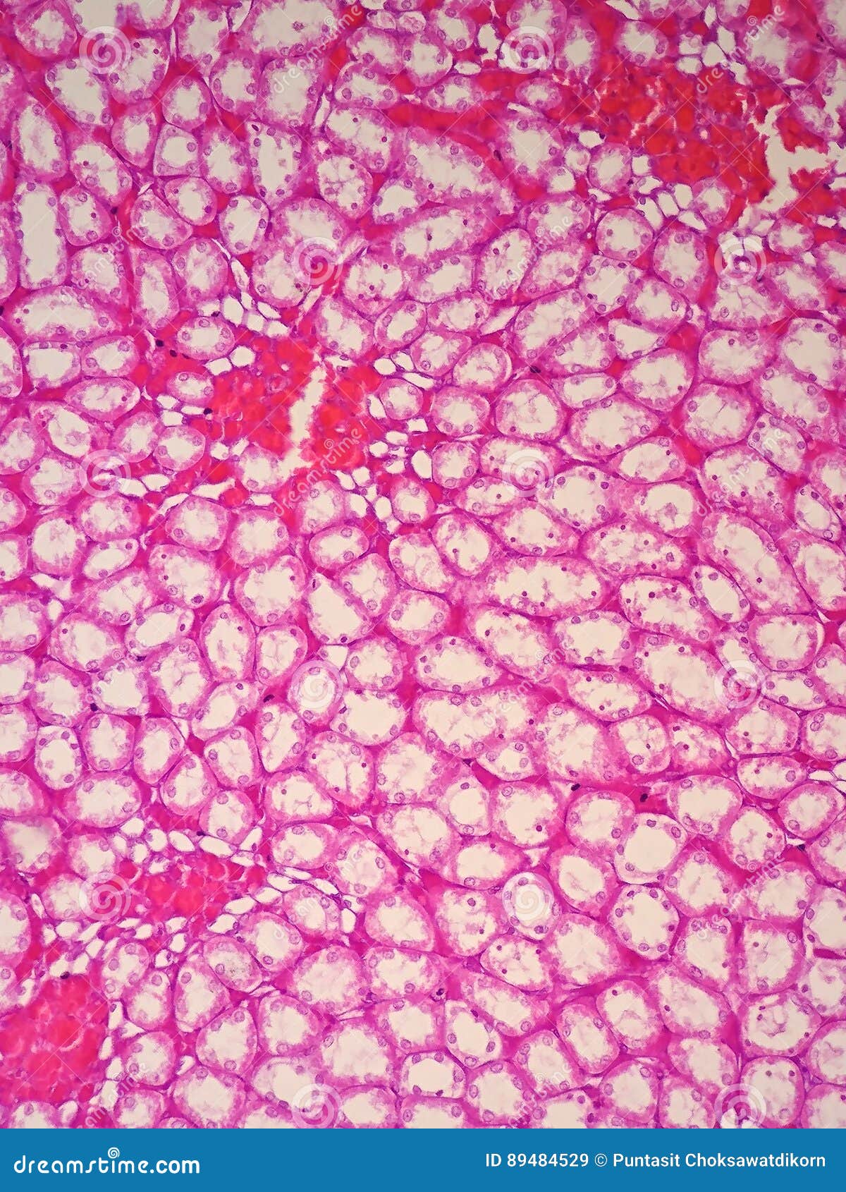 Histology of human kidney stock image. Image of cells - 89484529