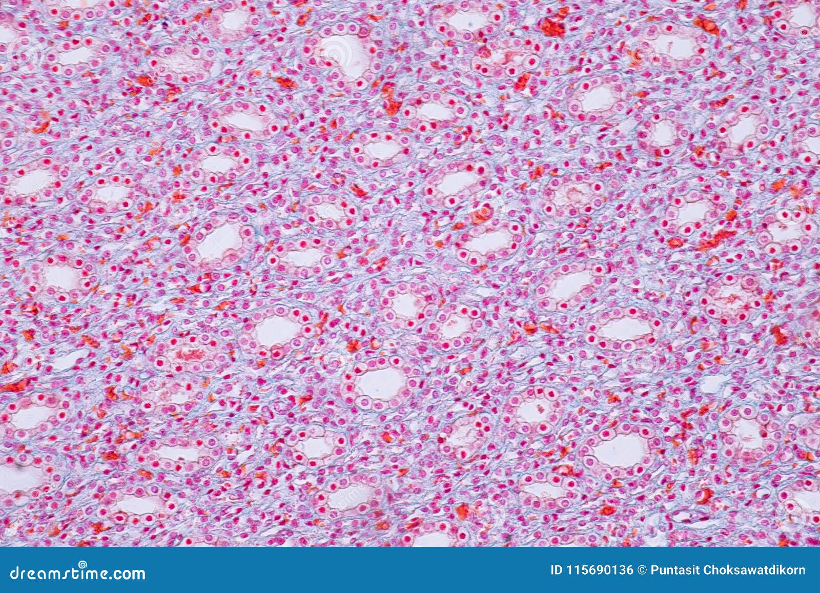 Histology of Human Kidney Under Microscope View for Education Stock ...