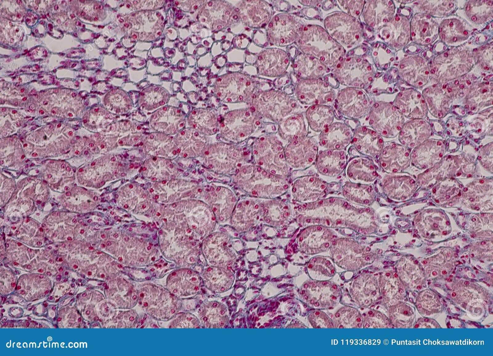 Histology Of Human Kidney Under Microscope View For Education Hi ...