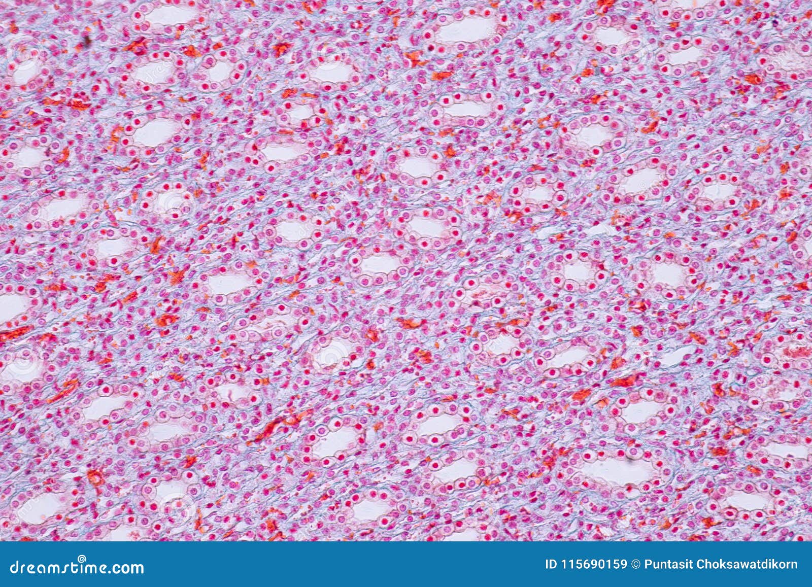 Histology of Human Kidney Under Microscope View Stock Image - Image of ...