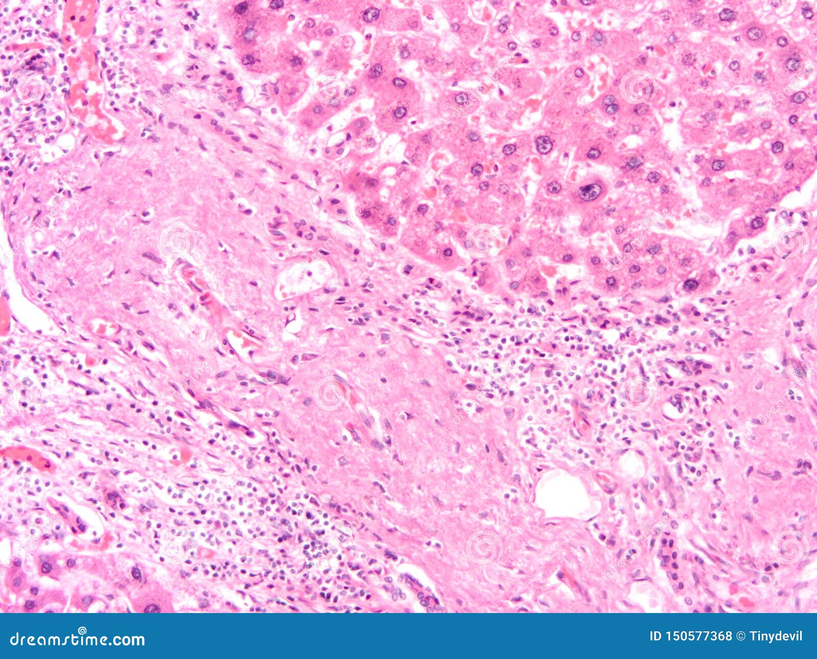 Histology of Human Liver Tissue Stock Photo - Image of show, doctor ...