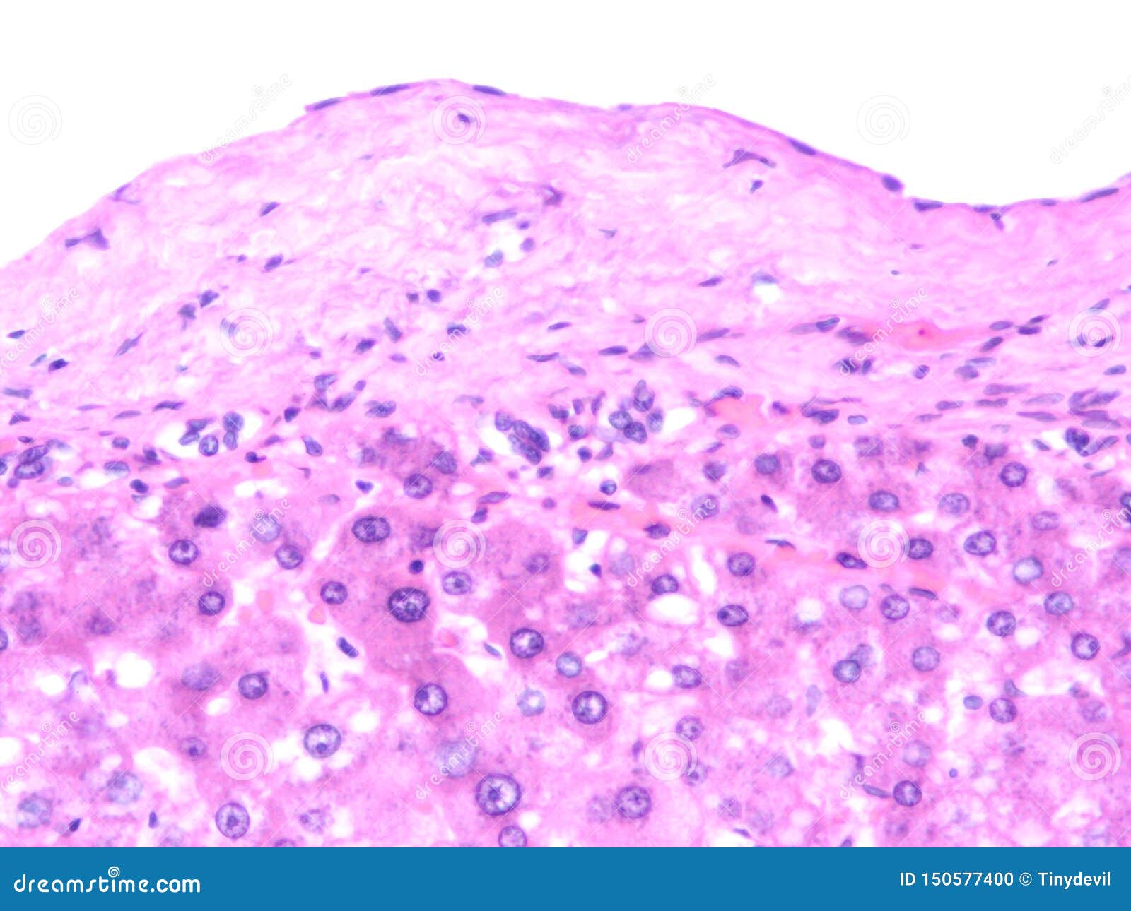Histology of Human Liver Tissue Stock Photo - Image of health, nucleus ...